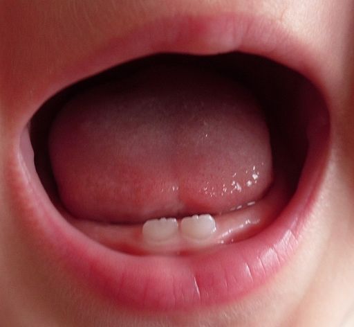 Teething: Myths, Facts, Do’s and Don’ts | My Two Hats
